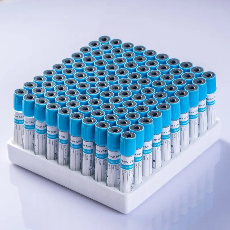 China Blue Coagulation Tube Manufacturers, Factory - Wholesale Service ...