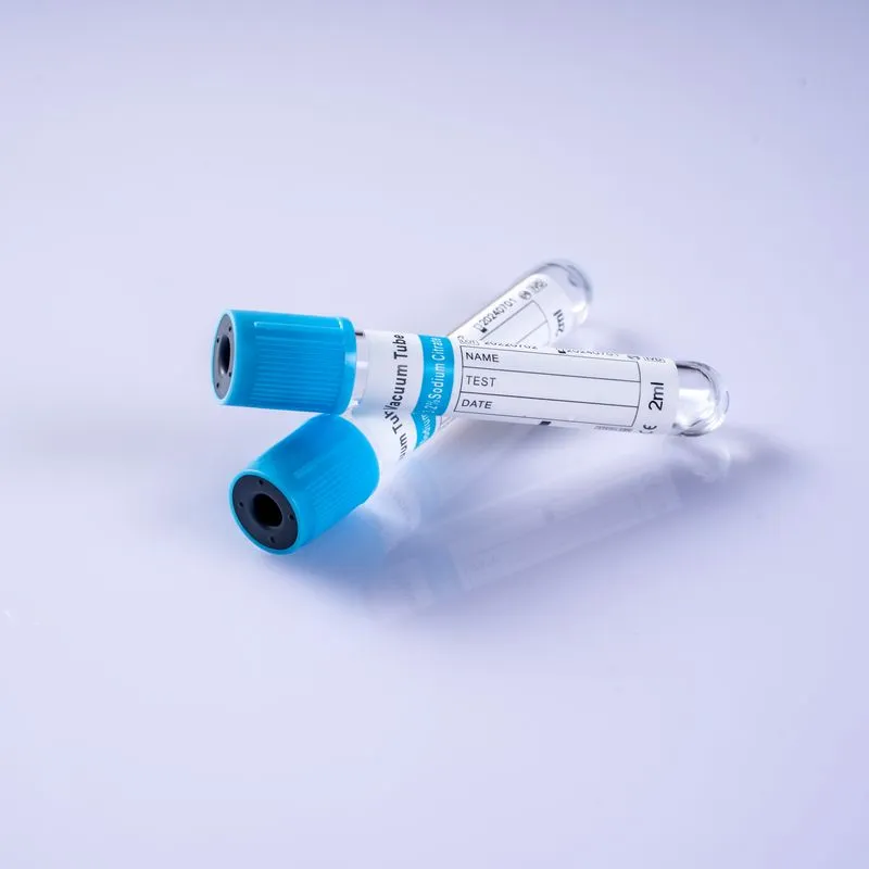 China Blue Coagulation Tube Manufacturers, Factory - Wholesale Service ...