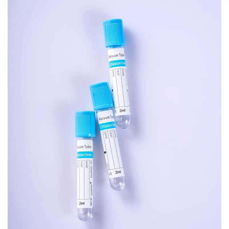 China Blue Coagulation Tube Manufacturers, Factory - Wholesale Service ...