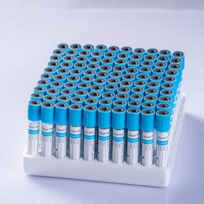 China Blue Coagulation Tube Manufacturers, Factory - Wholesale Service ...